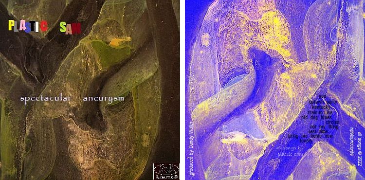 Spectacular Aneurysm – Plastic Sam – Unclarity